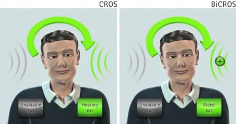 CROS and BiCROS Hearing Aids for Single Sided Deafness | All Ears ...